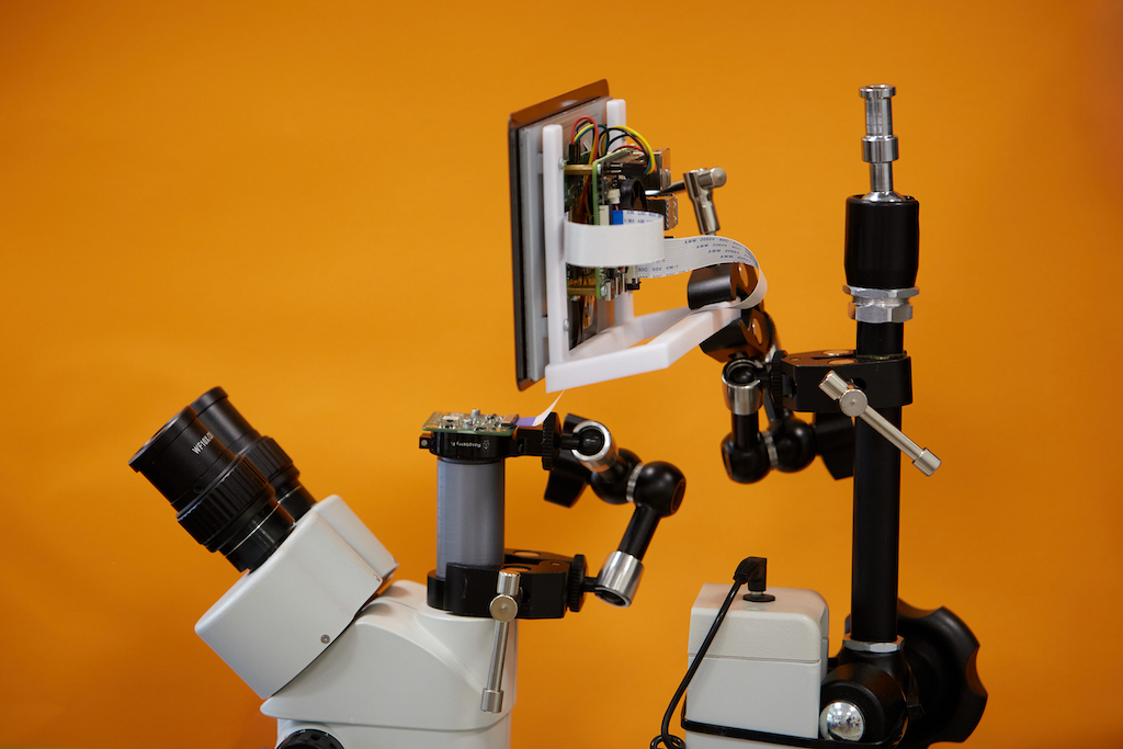 Artificial intelligence in a microscope